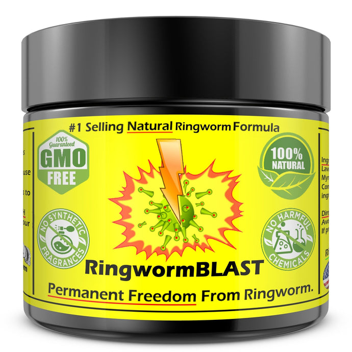 RingwormBLAST Ringworm FAST Powerful Relief Itching Severe Discomfort ...