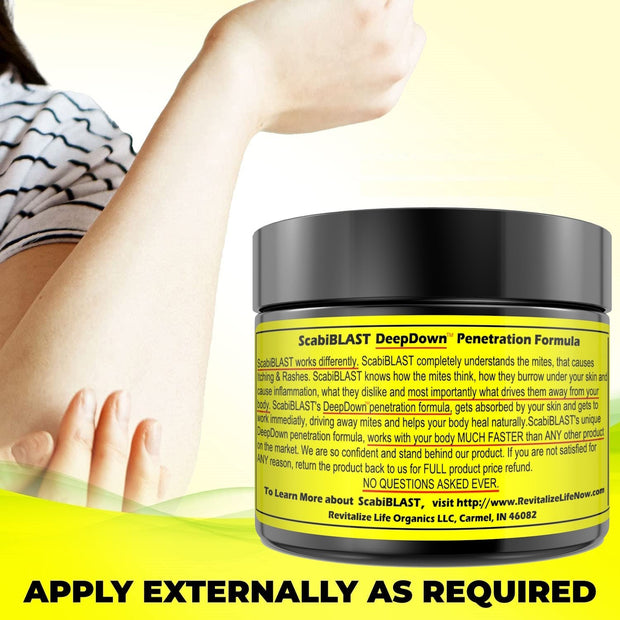 ScabiBLAST - Best Natural Scabies Itch Relief Salve on the Planet ...