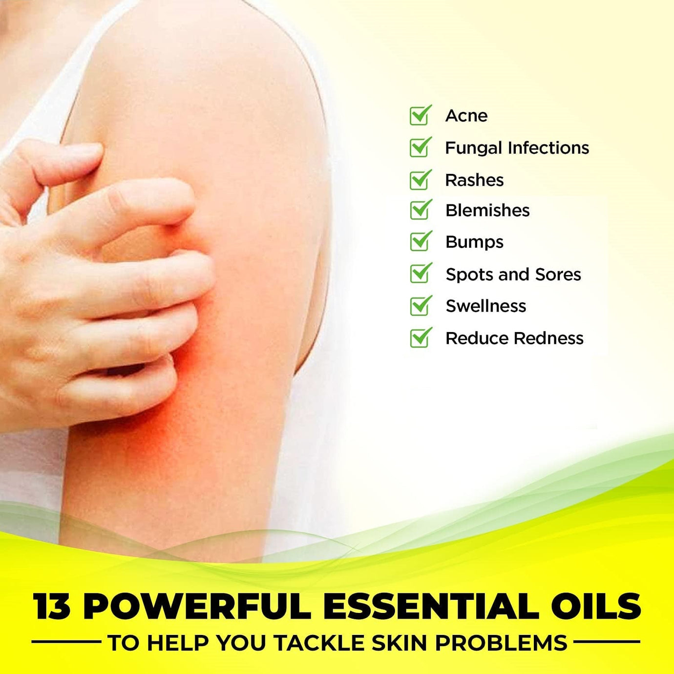 ScabiBLAST - Best Natural Scabies Itch Relief Salve on the Planet ...